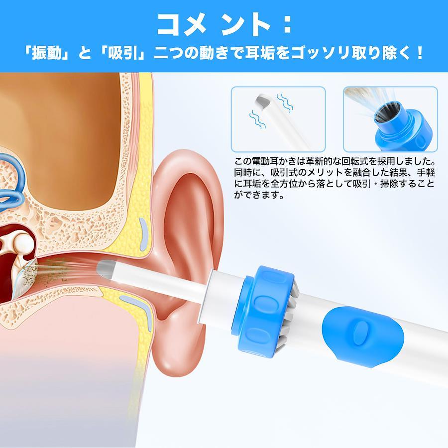 Earpick, Electric Earpick, Electric Ear Cleaner, Suction Type, Earwax Removal, Tweezers, For ...
